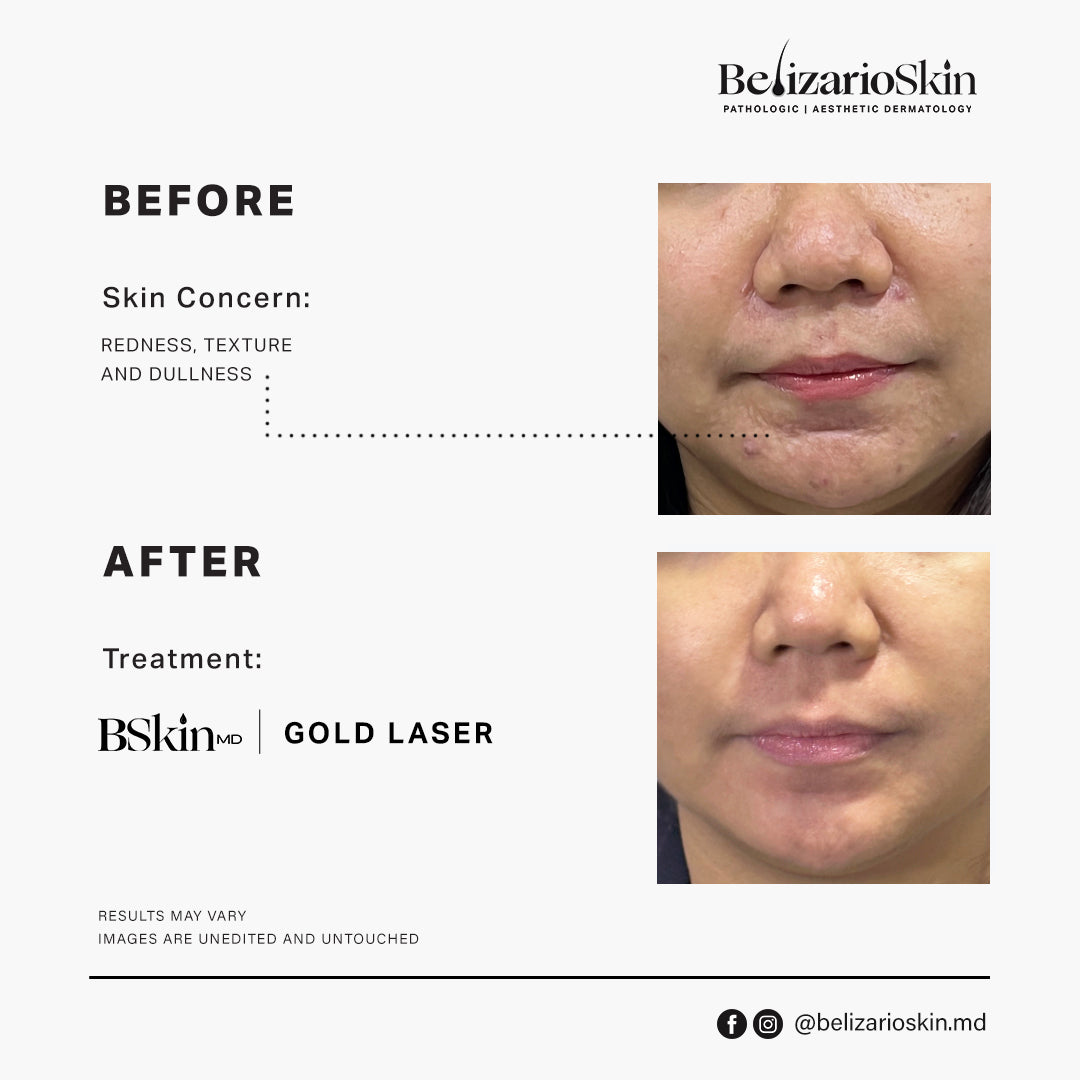 BelizarioSkin Pathologic and Aesthetic Dermatology – BelizarioSkin ...